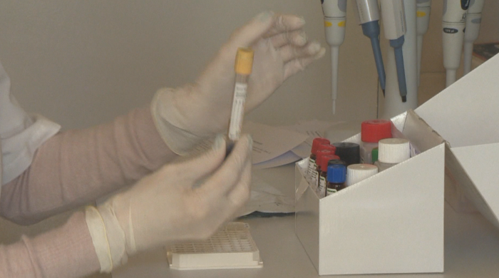 27 потвърдени случая на морбили в Пернишко от началото на годината - По ...